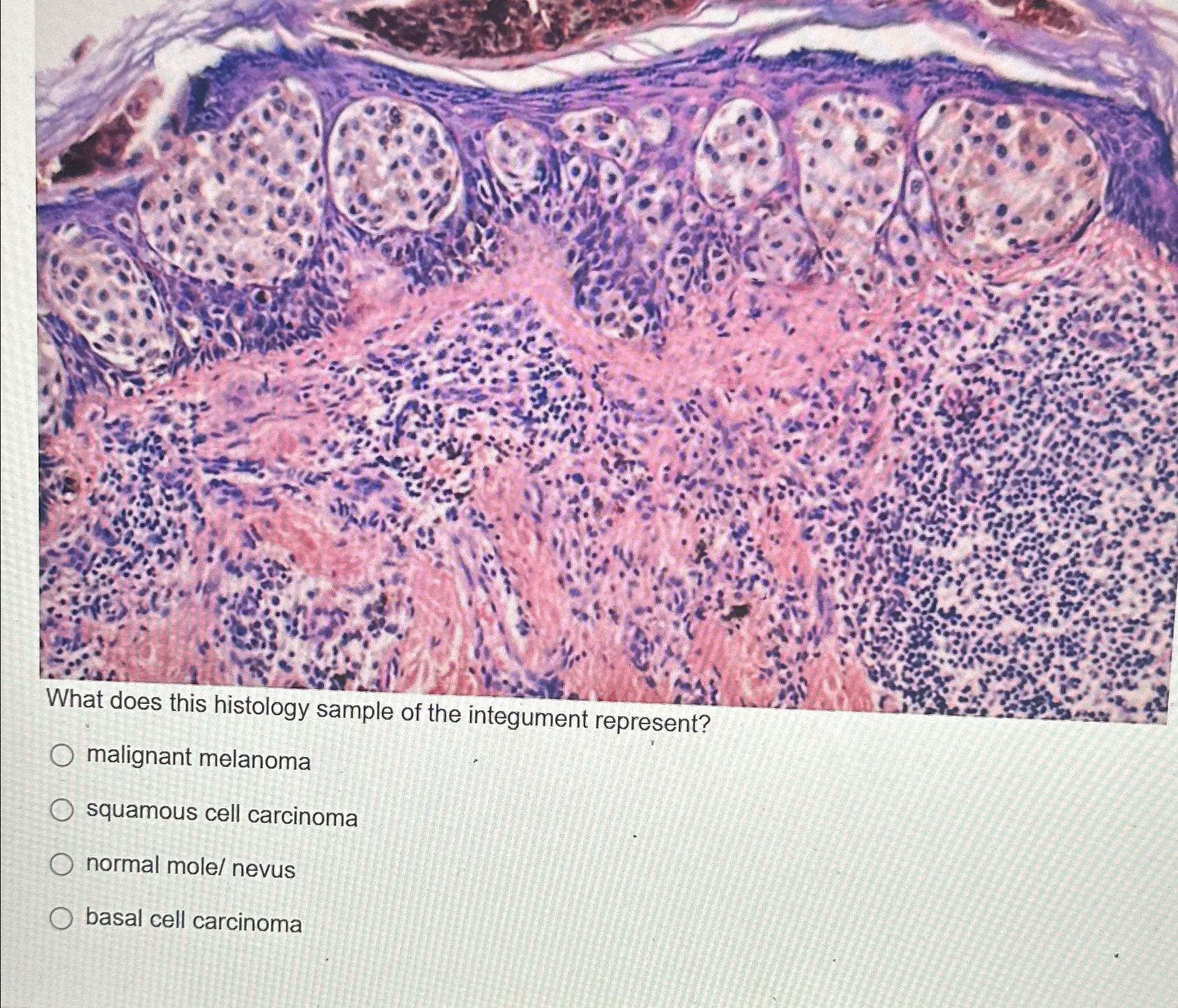 Solved What does this histology sample of the integument | Chegg.com