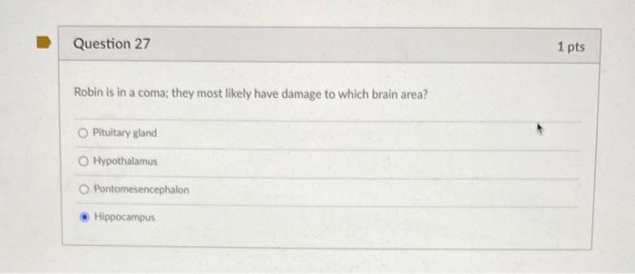 Solved Question 27 1 pts Robin is in a coma; they most | Chegg.com
