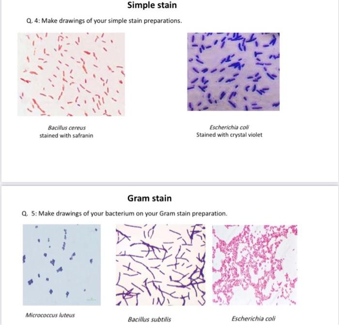 Bacillus Subtilis Gram Stain Positive Or Negative