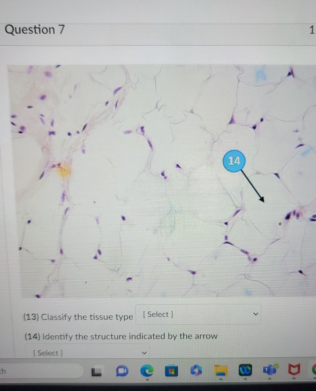 Solved (9) Classify the tissue type [ Select ] (10) Identify | Chegg.com