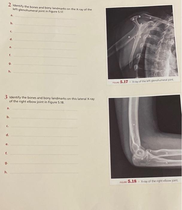 Solved 1 identify the bones and bony landmarks on the X-ray | Chegg.com