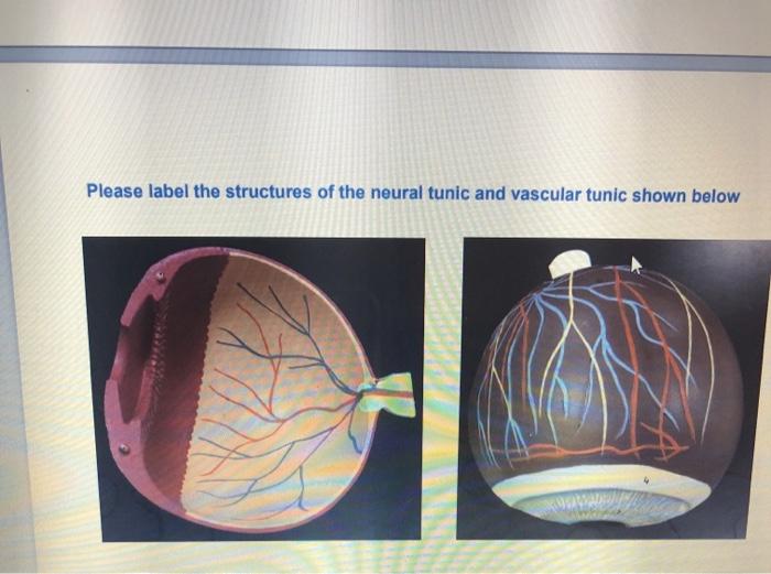 Solved Please label the structures of the neural tunic and | Chegg.com