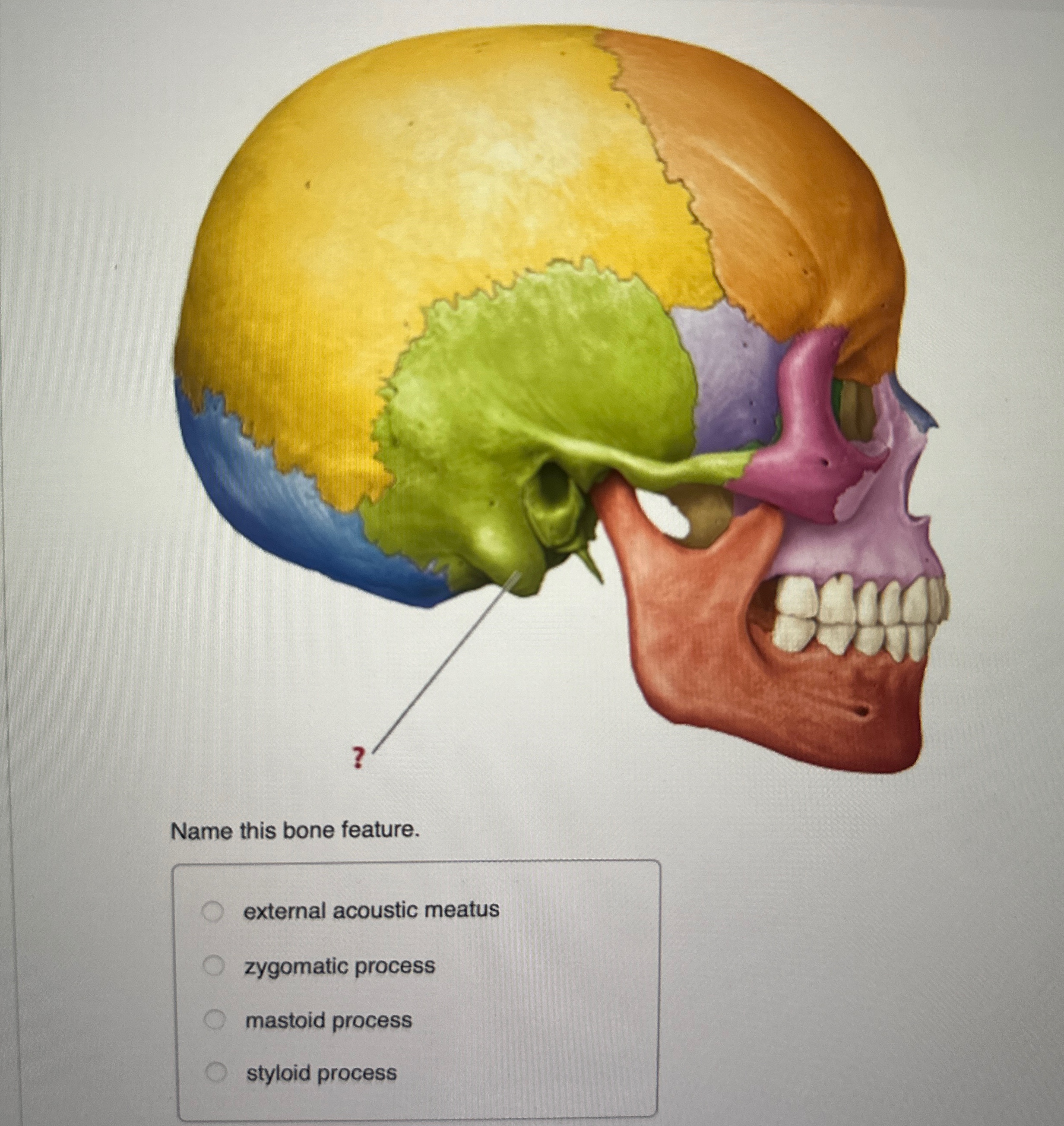 Solved Name this bone feature.external acoustic | Chegg.com