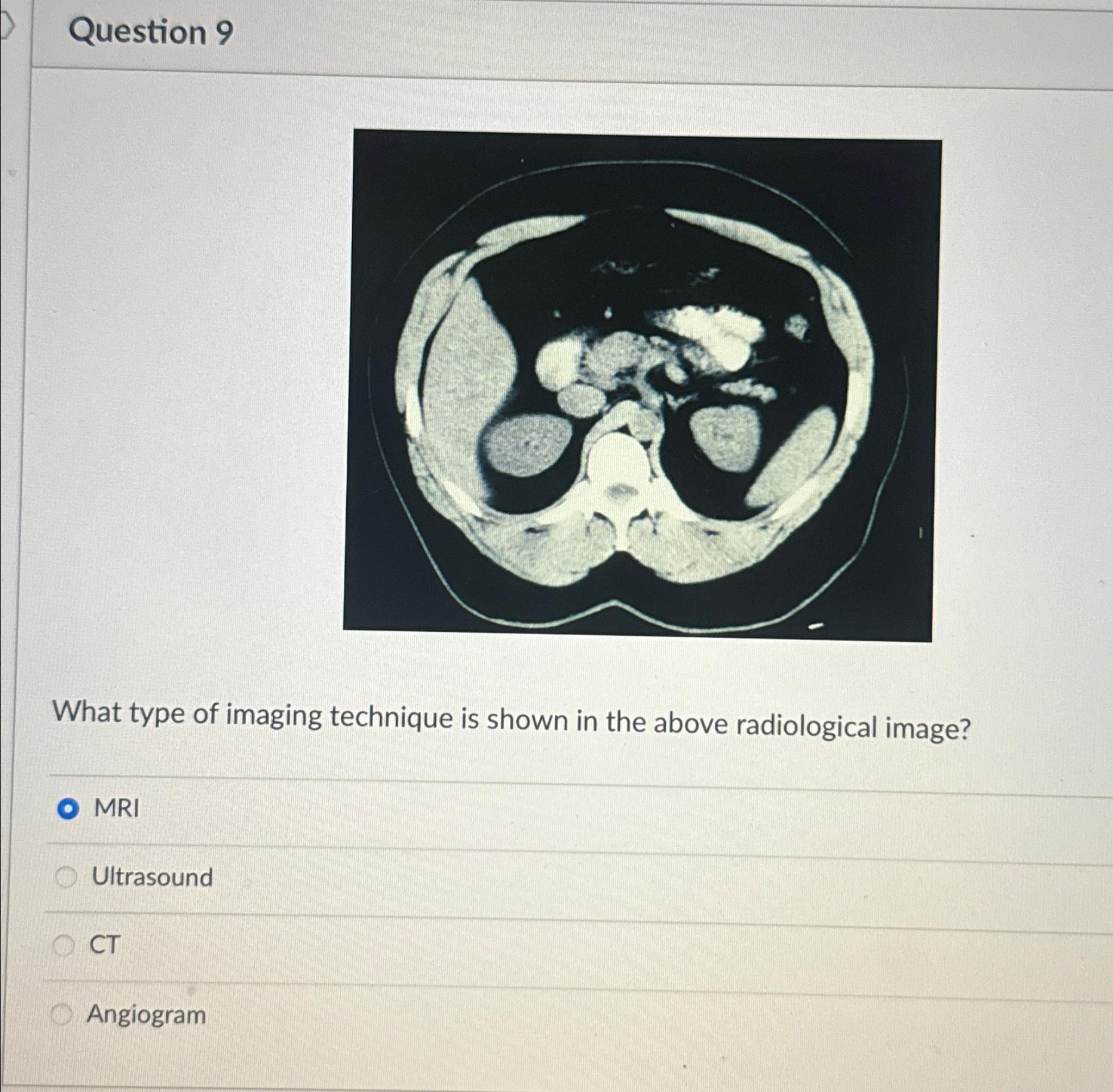 Solved Question 9What type of imaging technique is shown in | Chegg.com Solved Question 9What type of imaging technique is shown in | Chegg.com