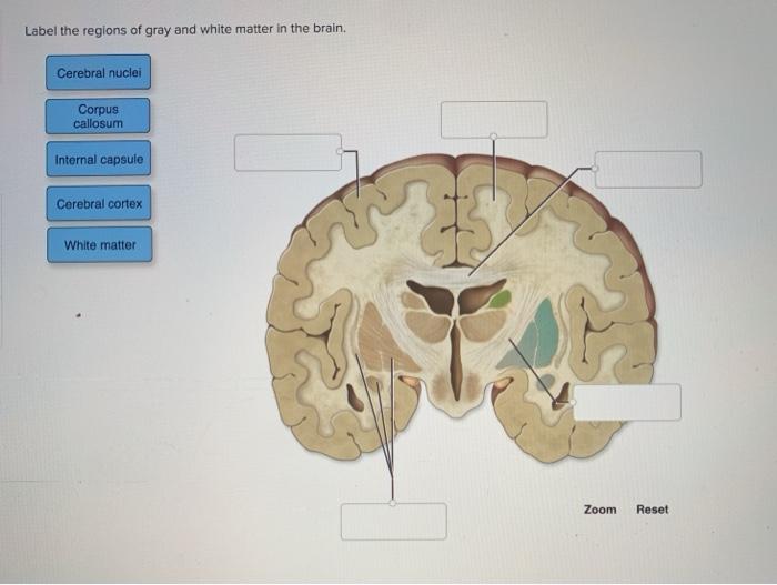 Solved Label the regions of gray and white matter in the | Chegg.com