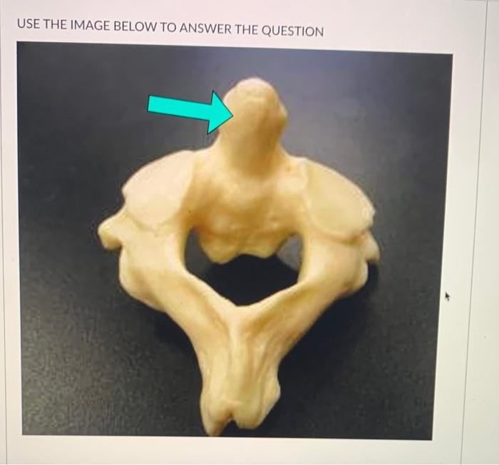 Solved what is the name of the bone the arrow is pointing | Chegg.com