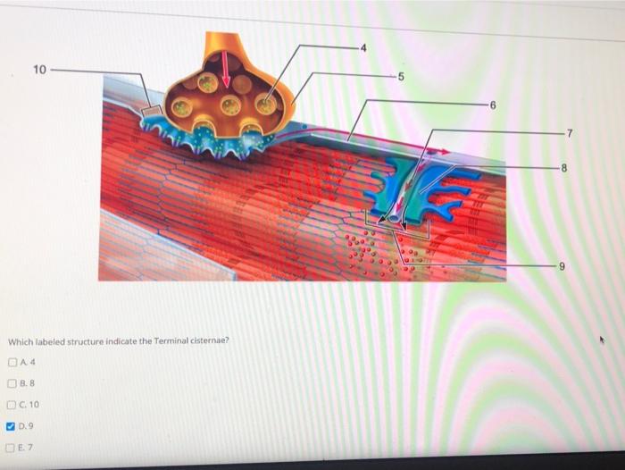 Solved 10 8 Which labeled structure indicate the Terminal | Chegg.com