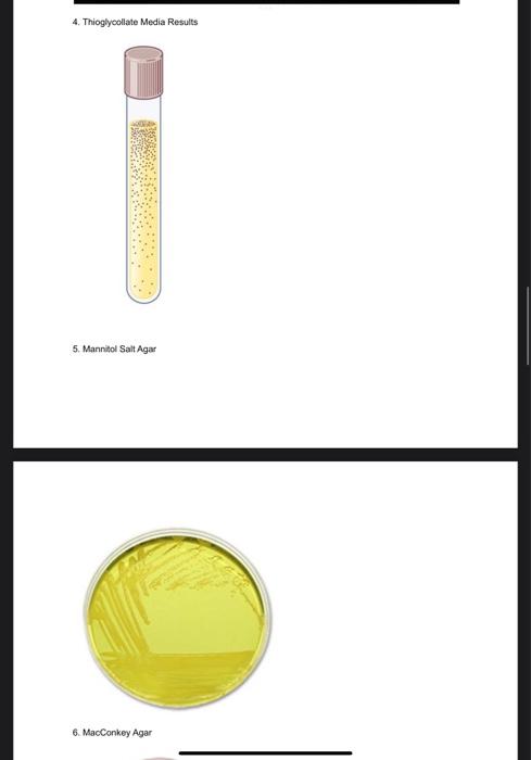 Solved Y 4. Thioglycolate Media Results 5. Mannitol Salt | Chegg.com