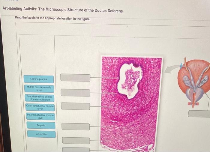 Solved Art-labeling Activity: The Microscopic Structure of | Chegg.com