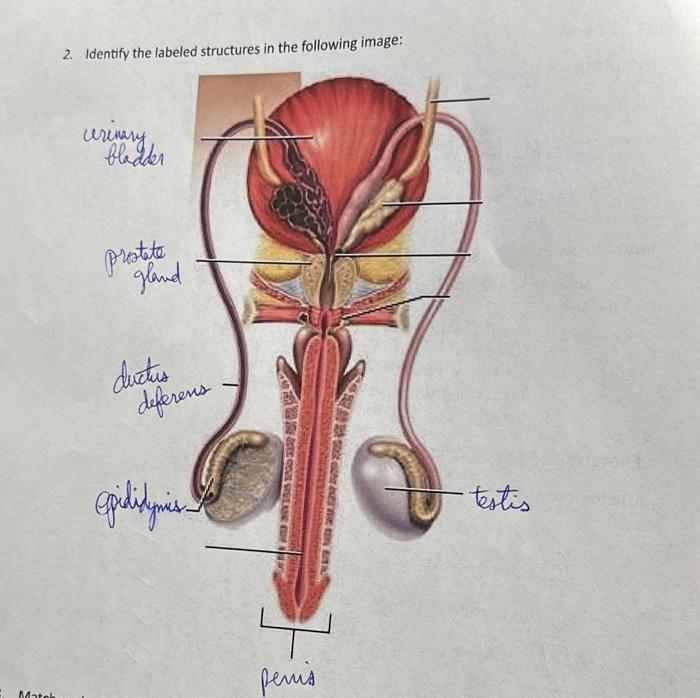 Solved 2. Identify the labeled structures in the following | Chegg.com