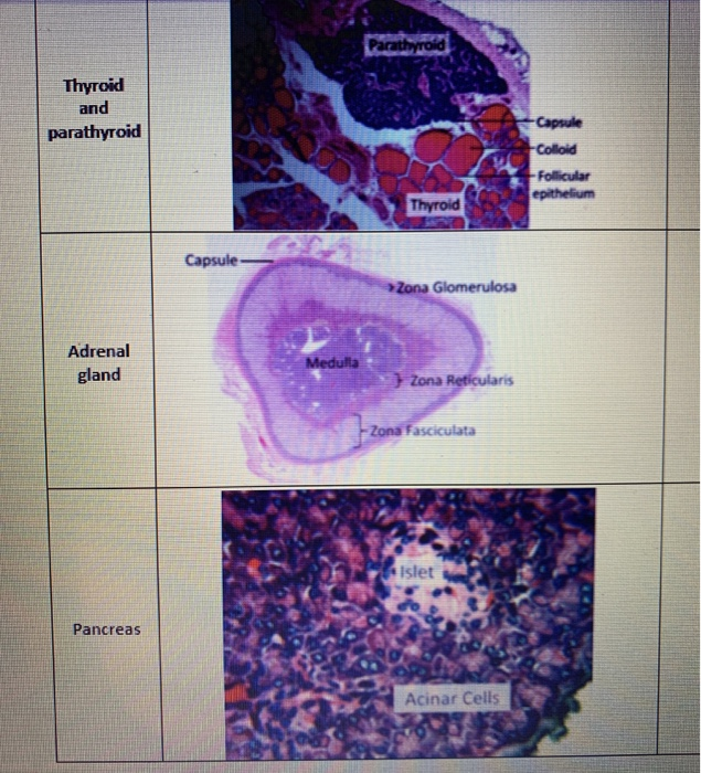 Solved Photo Acidophil cell Basophil cell Anterior pituitary | Chegg.com