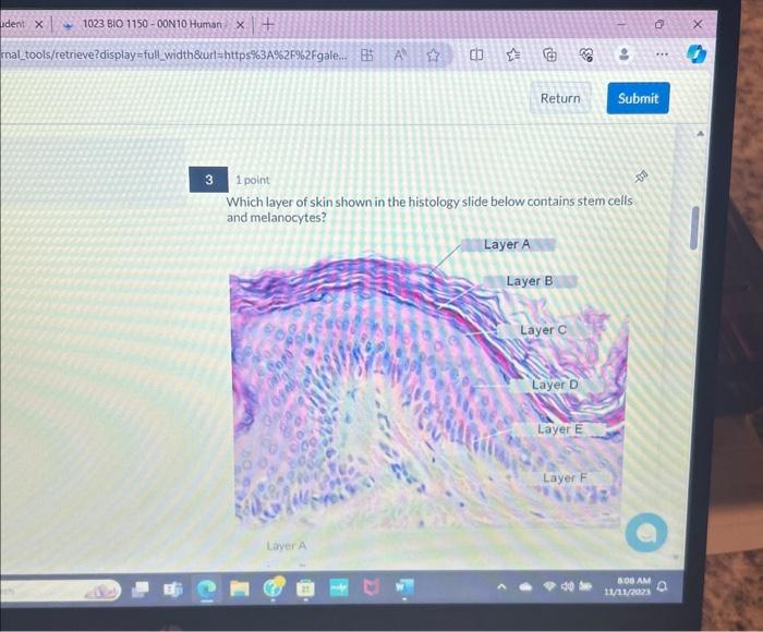 Solved which layer of skin shown in the histology slide | Chegg.com