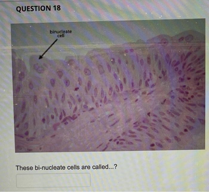 Solved QUESTION 18 binucleate cell These bi-nucleate cells | Chegg.com