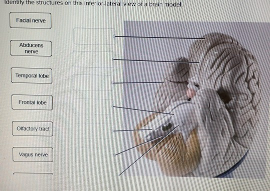 Solved Identity the structures on this lateral view of a | Chegg.com