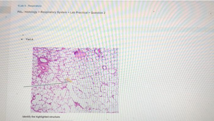 Solved CLab. Respiratory PAL: Histology > Respiratory System | Chegg.com Solved CLab. Respiratory PAL: Histology > Respiratory System | Chegg.com