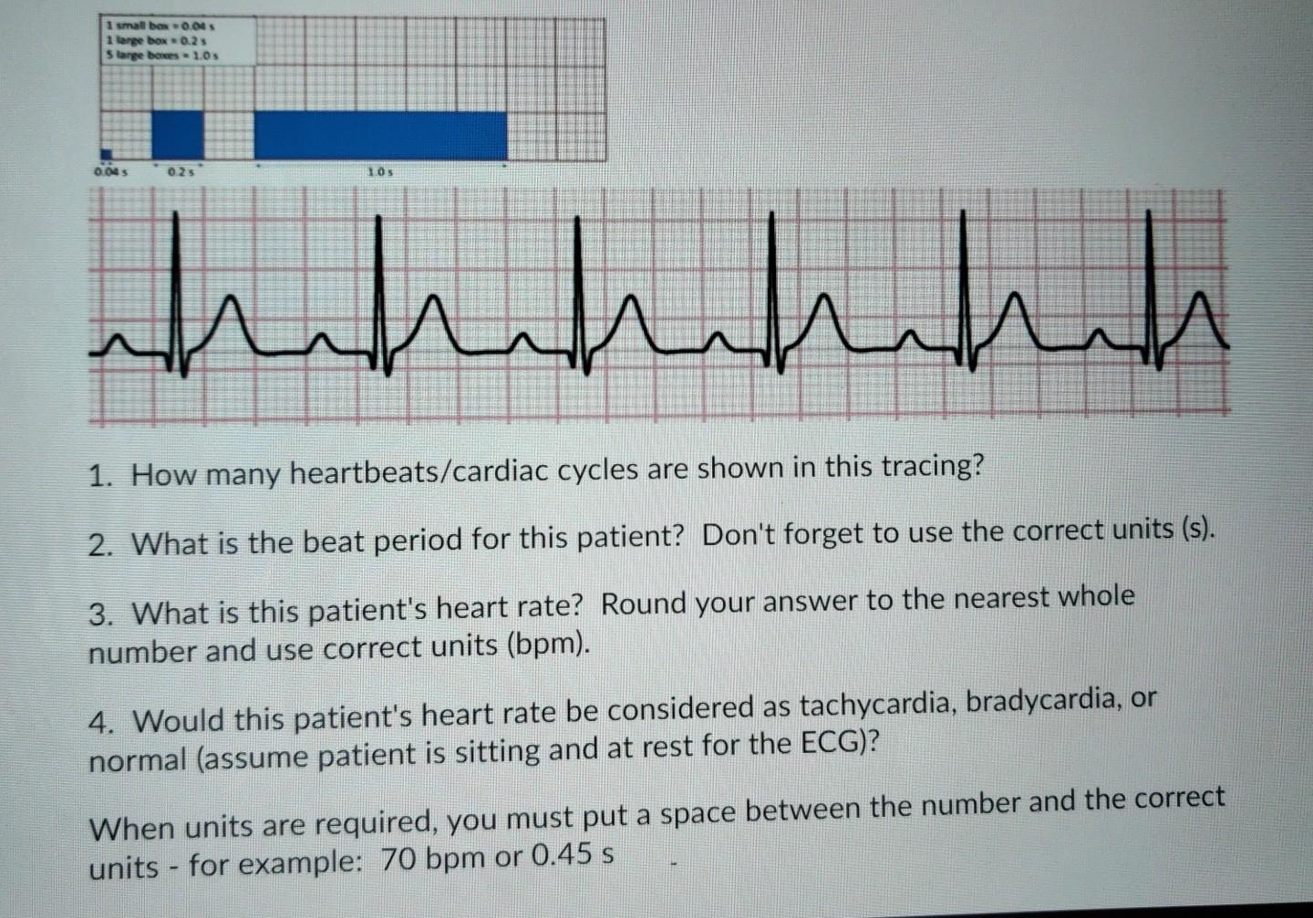 Solved SO lange box=023 *100= wees! 1 smal box -0.005 1 | Chegg.com