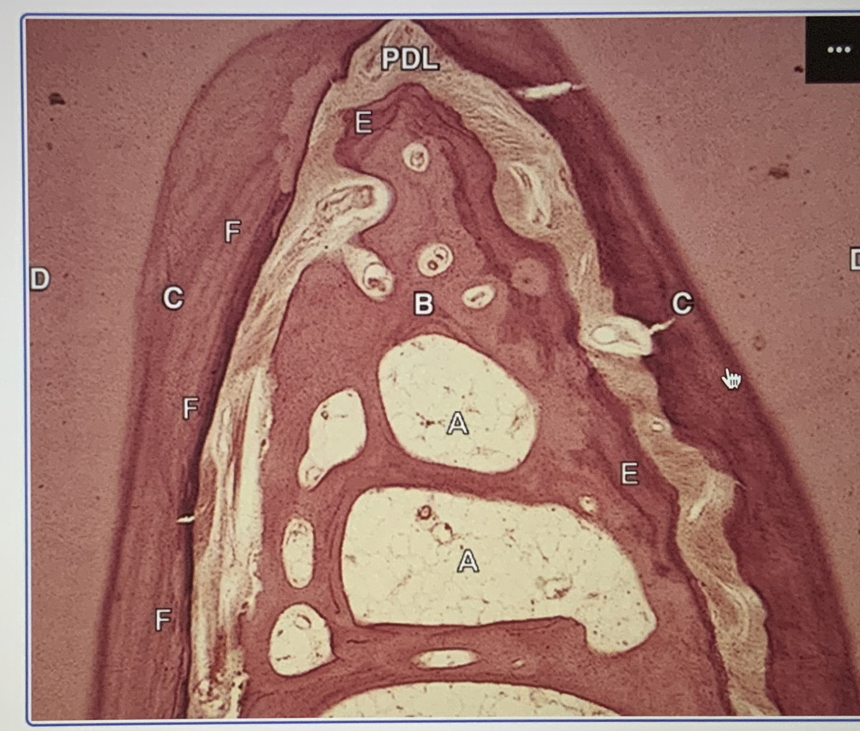 Label the slide:Options = ﻿interradicular septum, | Chegg.com