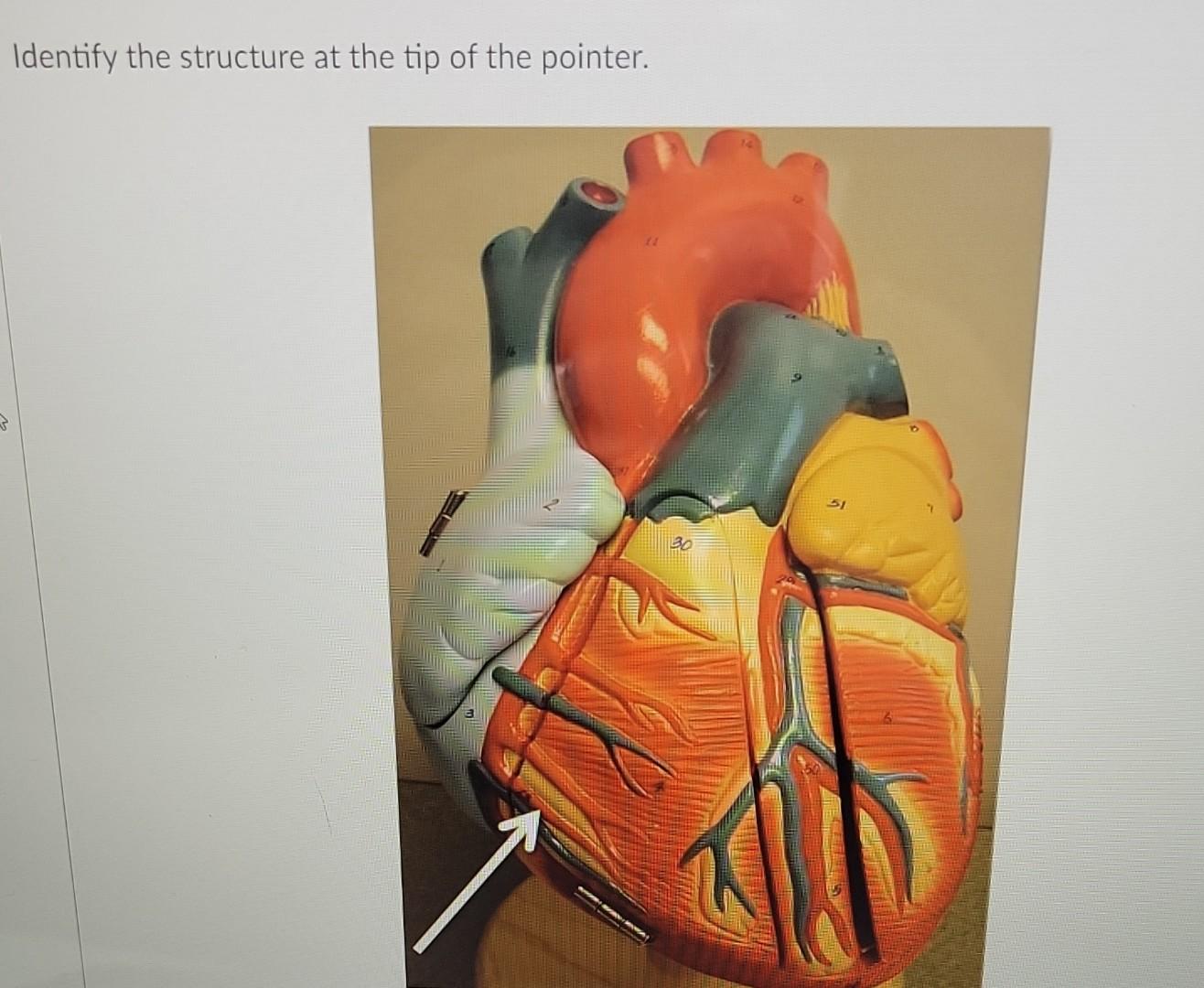 Solved dentify the structure at the tip of the | Chegg.com