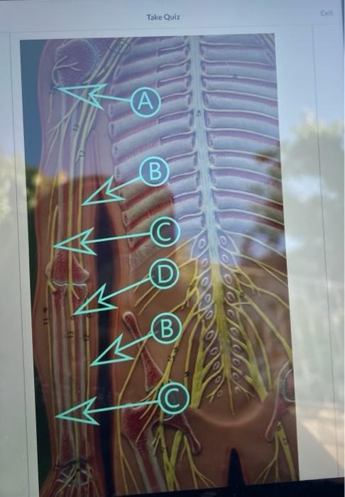Solved These features are discussed in Nervous System | Chegg.com Solved These features are discussed in Nervous System | Chegg.com