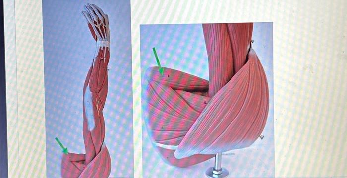 Solved what is the name of the indicated muscle? the green | Chegg.com