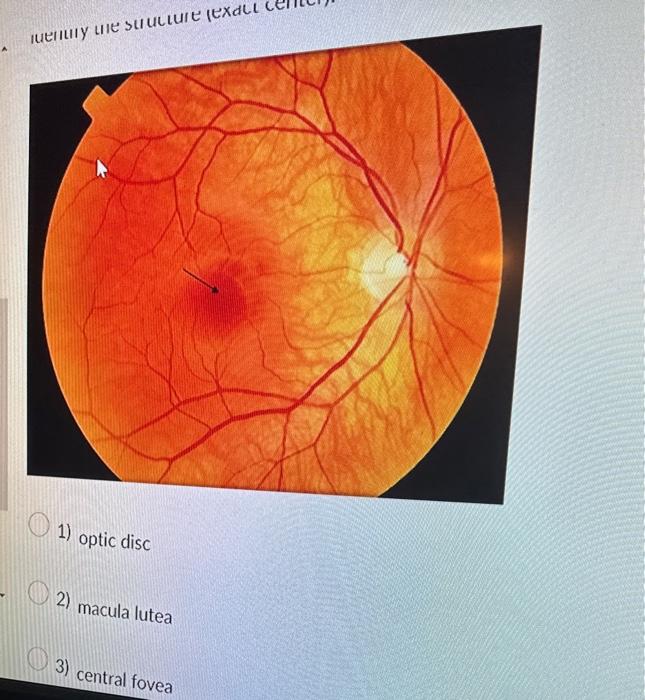 Solved 1) optic disc 2) macula lutea 3) central fovea 1) | Chegg.com