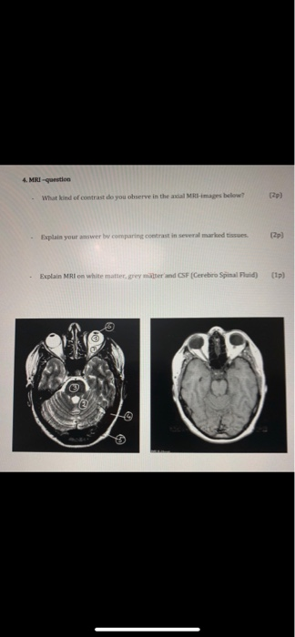 Solved 4. MRI-question What kind of contrast do you observe | Chegg.com