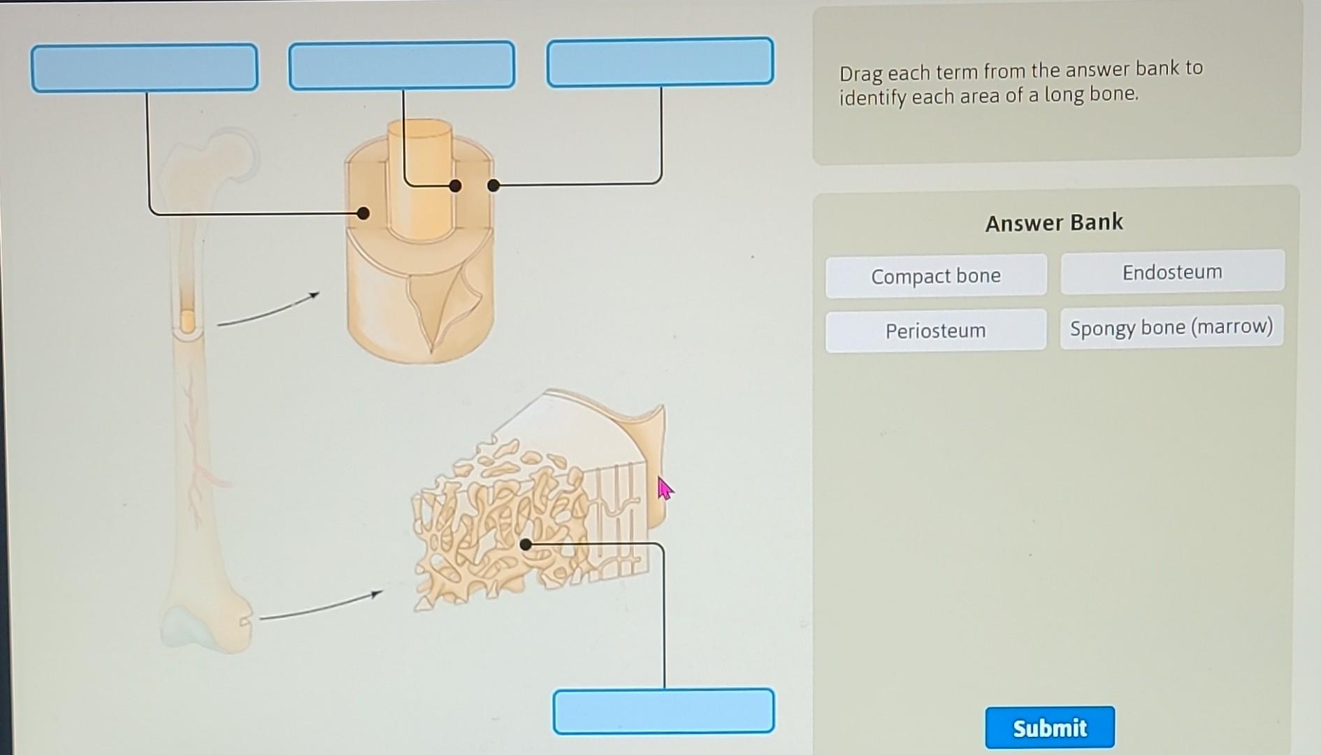 Solved Drag each term from the answer bank to identify each | Chegg.com