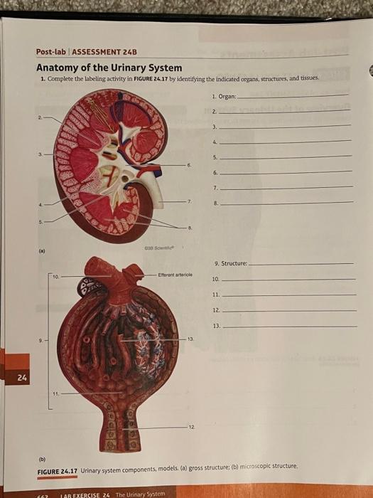 Solved Anatomy of the Urinary System 1. Complete the | Chegg.com