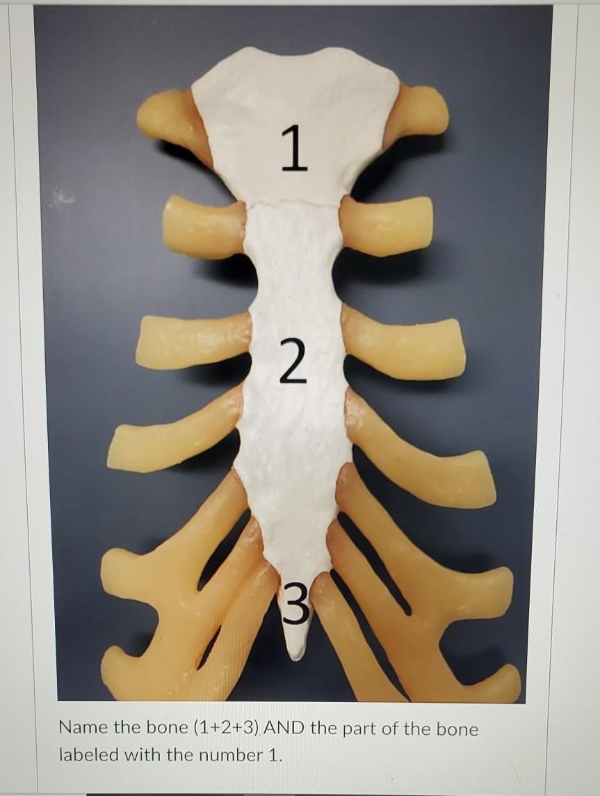 Solved 1 2. Name the bone (1+2+3) AND the part of the bone | Chegg.com