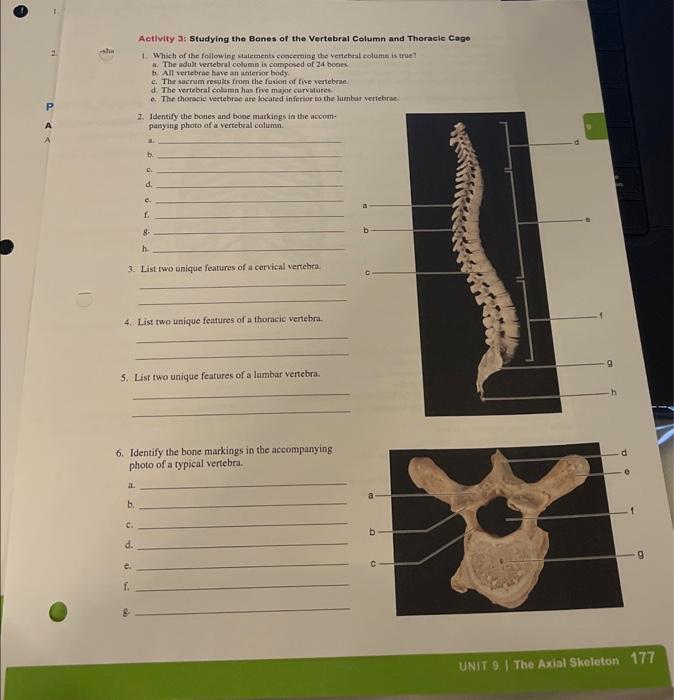 Solved Activity 3: Studying the Bones of the Vertebral | Chegg.com