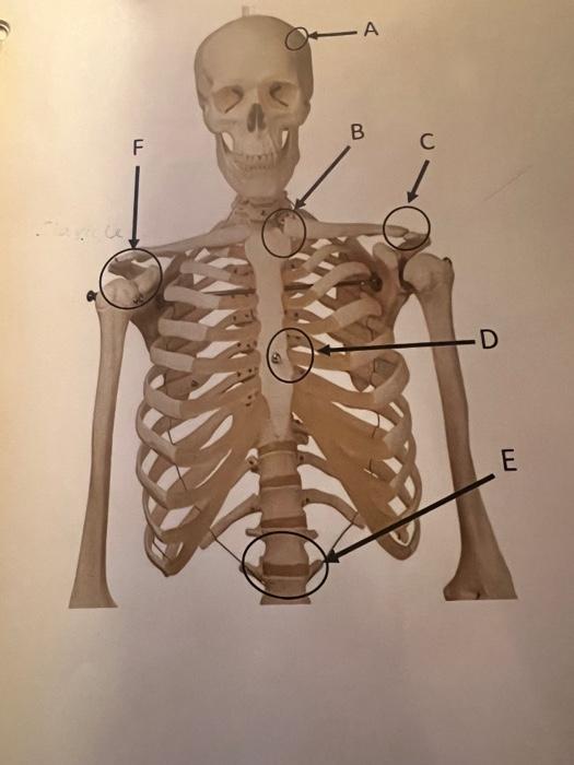 Solved please help me label the name of the joints | Chegg.com Solved please help me label the name of the joints | Chegg.com