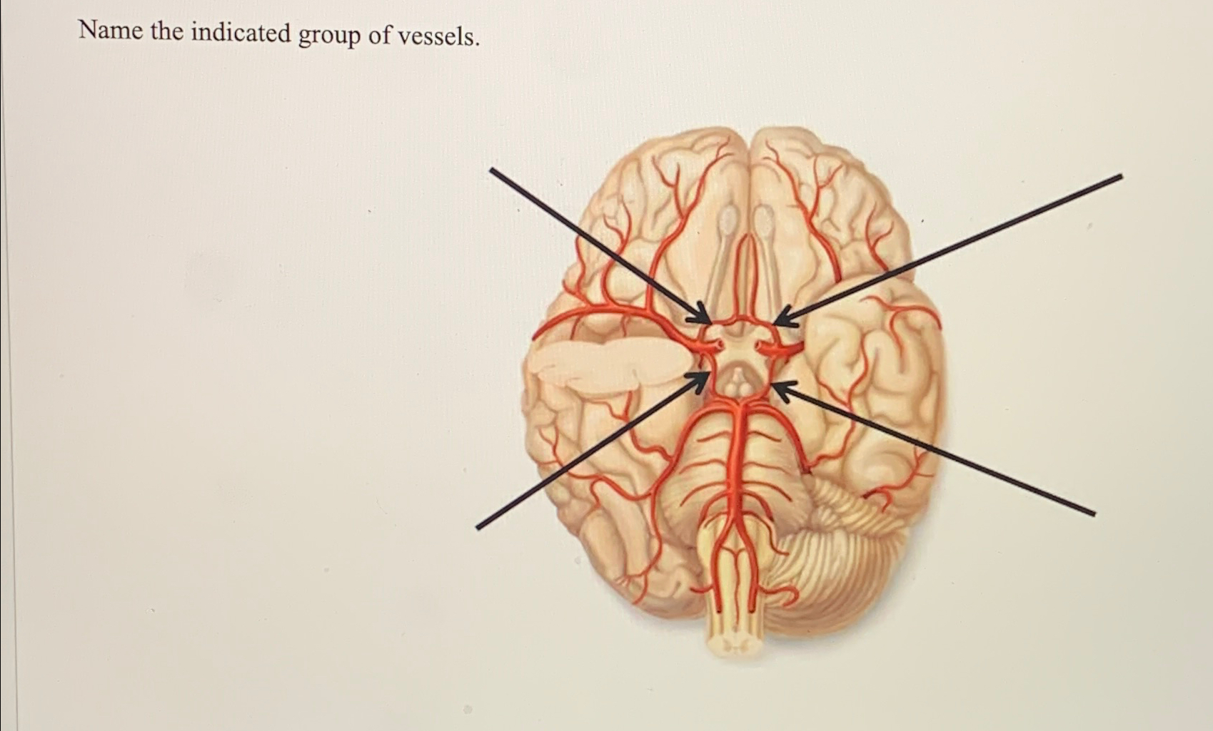 Solved Name the indicated group of vessels. | Chegg.com