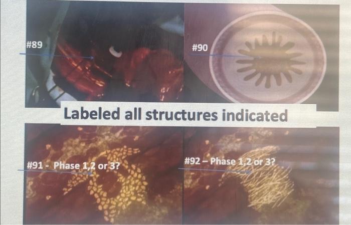 Solved #89 TAP M Labeled all structures indicated # 91- | Chegg.com