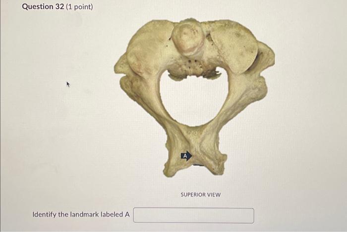 Solved Question 32 (1 point) Identify the landmark labeled A | Chegg.com