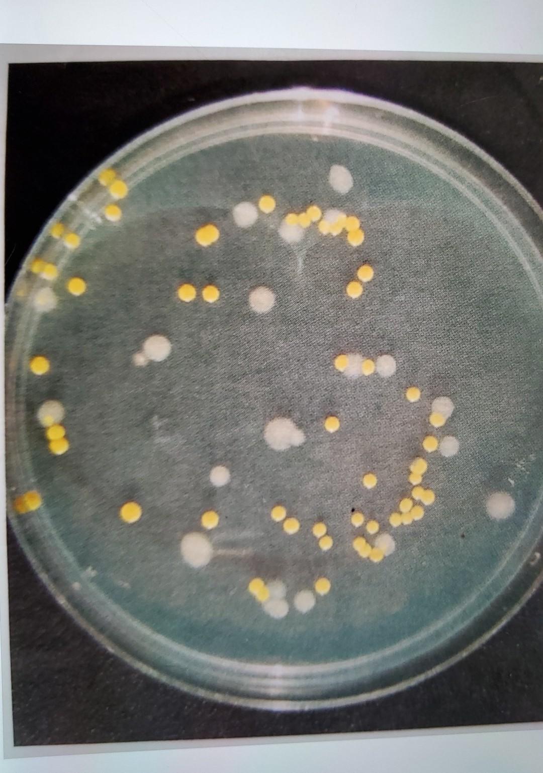 Solved ENVIRON SPEEHMEN Spread-Plate Technique Streak-Plate | Chegg.com