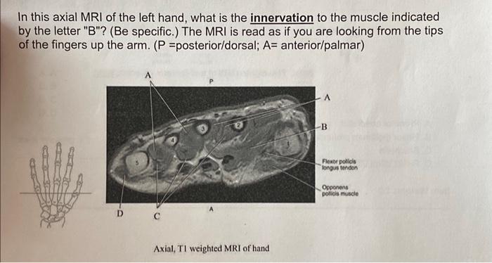 Solved In this axial MRI of the left hand, what is the | Chegg.com