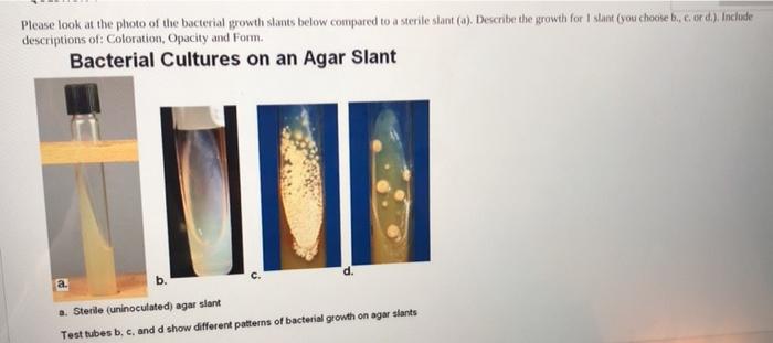 Solved Please look at the photo of the bacterial growth | Chegg.com