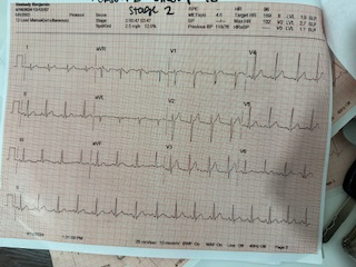 Solved 1. ﻿Is the rhythm regular or irregular?2. ﻿Determine | Chegg.com