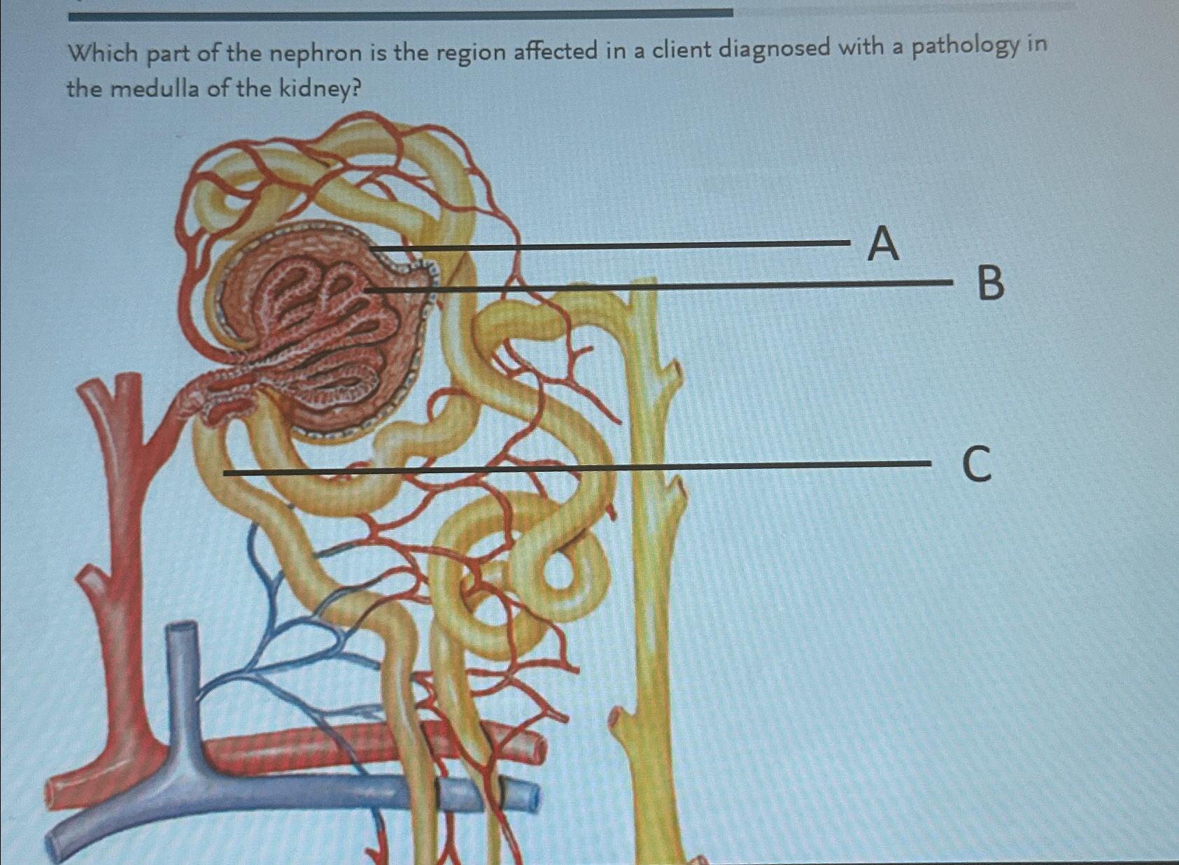 Solved Which part of the nephron is the region affected in a | Chegg.com