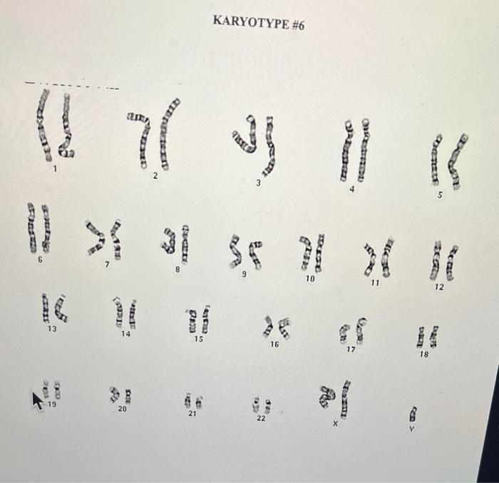 Solved 6. Examine the following karyotypes and answer the | Chegg.com