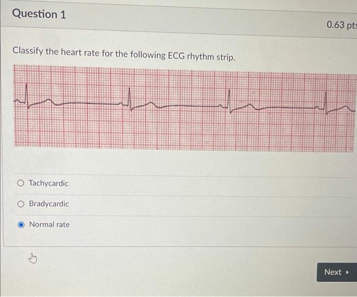 Solved Question 1 0.63 pts Classify the heart rate for the | Chegg.com