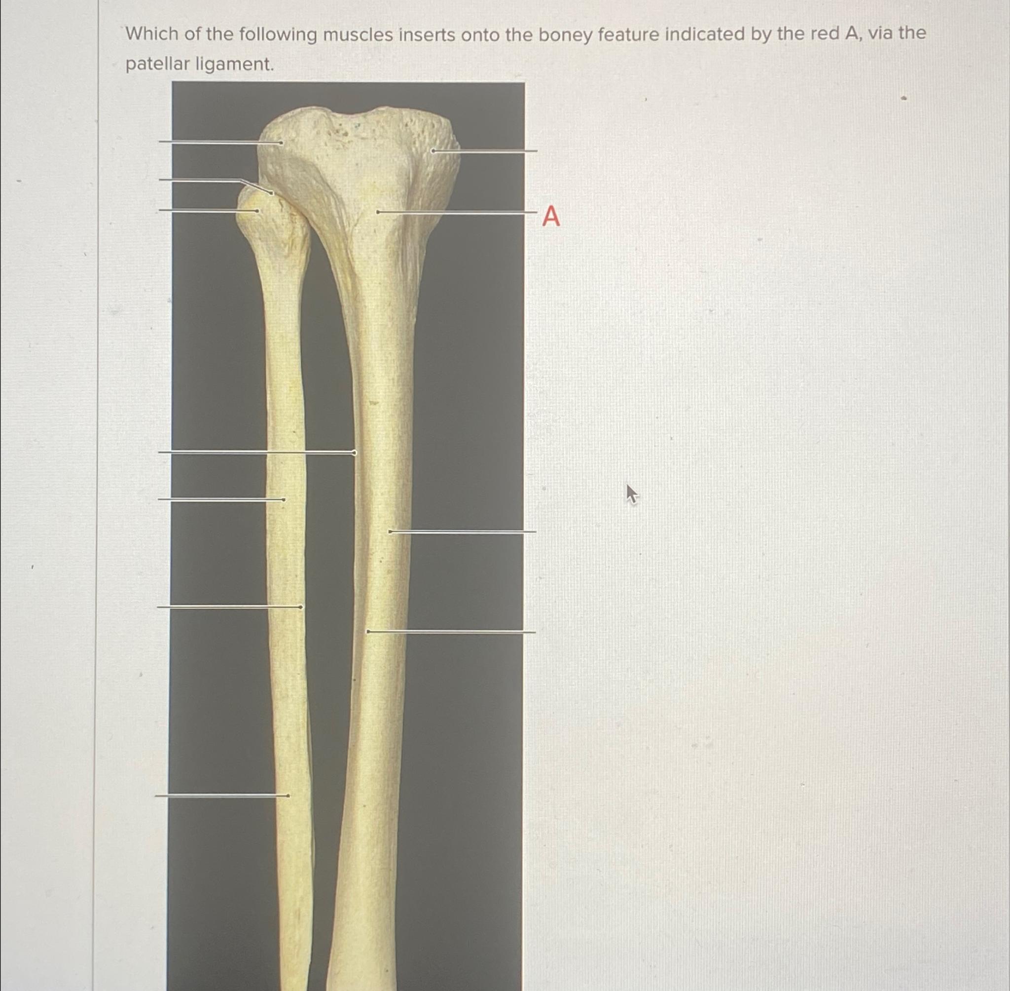 Solved Which of the following muscles inserts onto the boney | Chegg.com