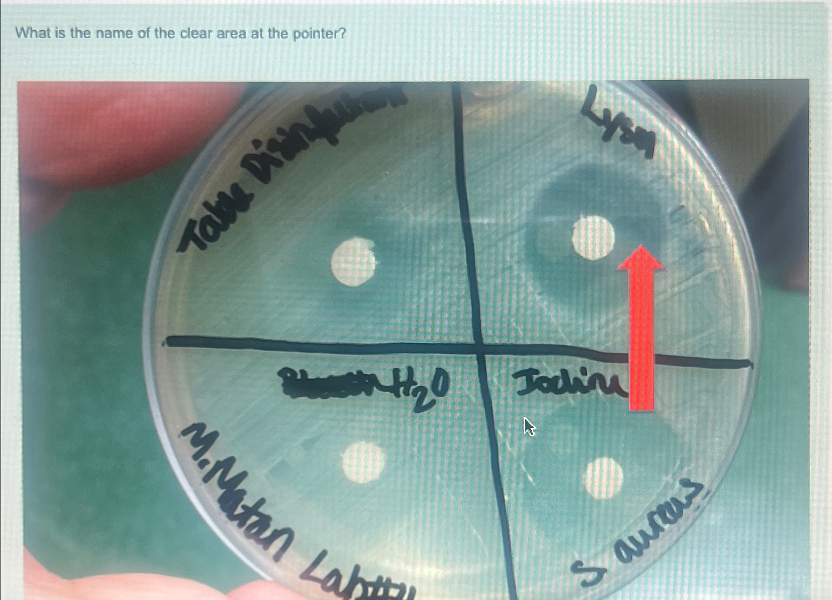 Solved What is the name of the clear area at the pointer? | Chegg.com