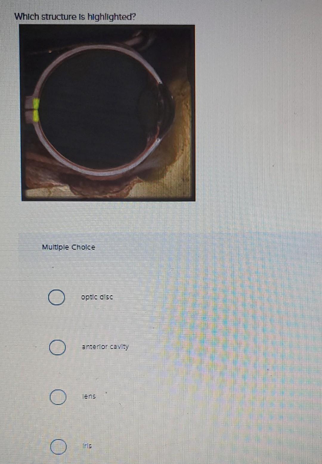 Solved Which structure is highilghted? Multiple Cholce optic | Chegg.com