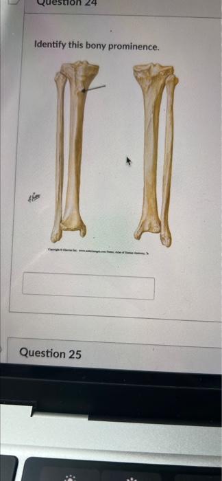 Solved on 24 Identify this bony prominence. the Question 25 | Chegg.com