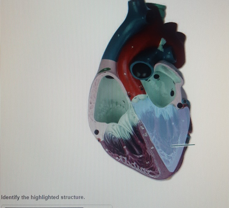 Solved 1-G92: Giant Identify the highlighted structures. | Chegg.com