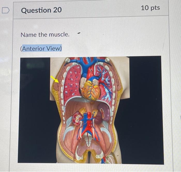 Solved Name the muscle. | Chegg.com