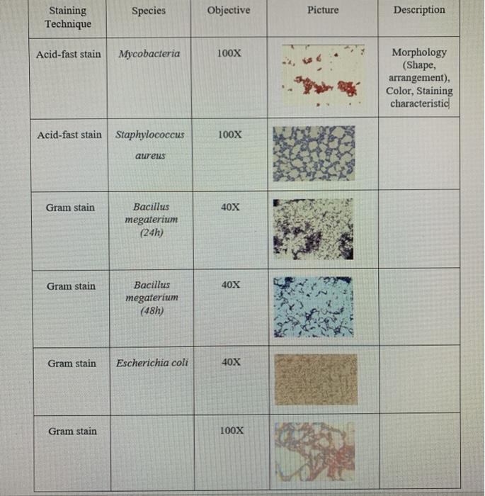 Solved Species Objective Picture Staining Technique | Chegg.com Solved Species Objective Picture Staining Technique | Chegg.com