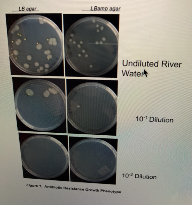 LB agar LBamp agar Undiluted River Watert 10-1 | Chegg.com