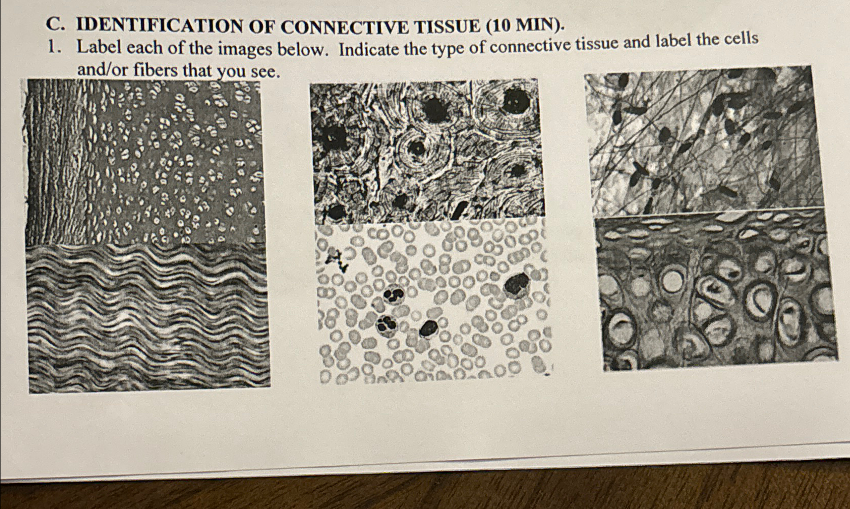 Solved C. IDENTIFICATION OF CONNECTIVE TISSUE (10 | Chegg.com Solved C. IDENTIFICATION OF CONNECTIVE TISSUE (10 | Chegg.com